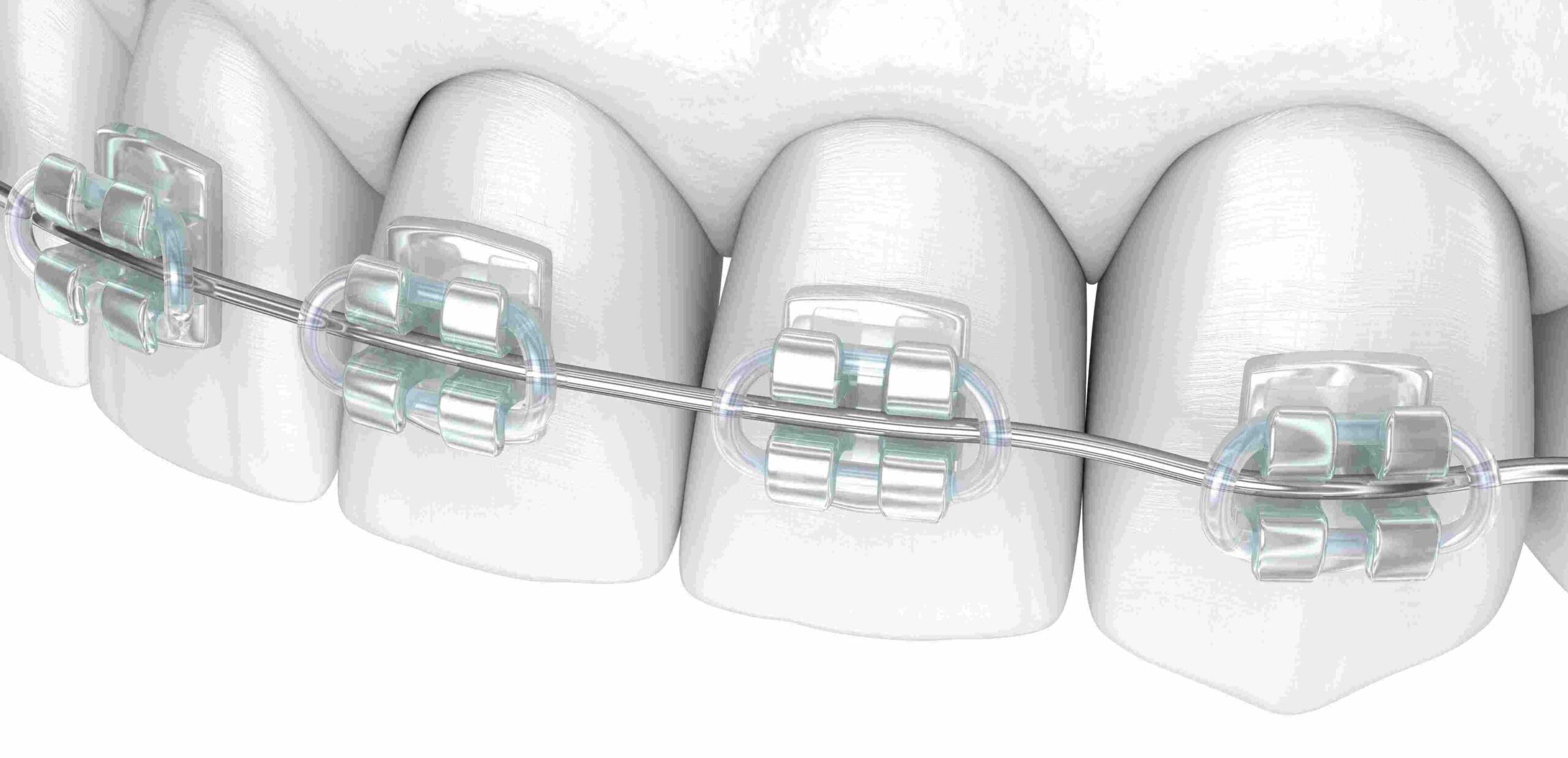 Back to basics. Ten top tips on alignment. - Kevin O'Brien's ...